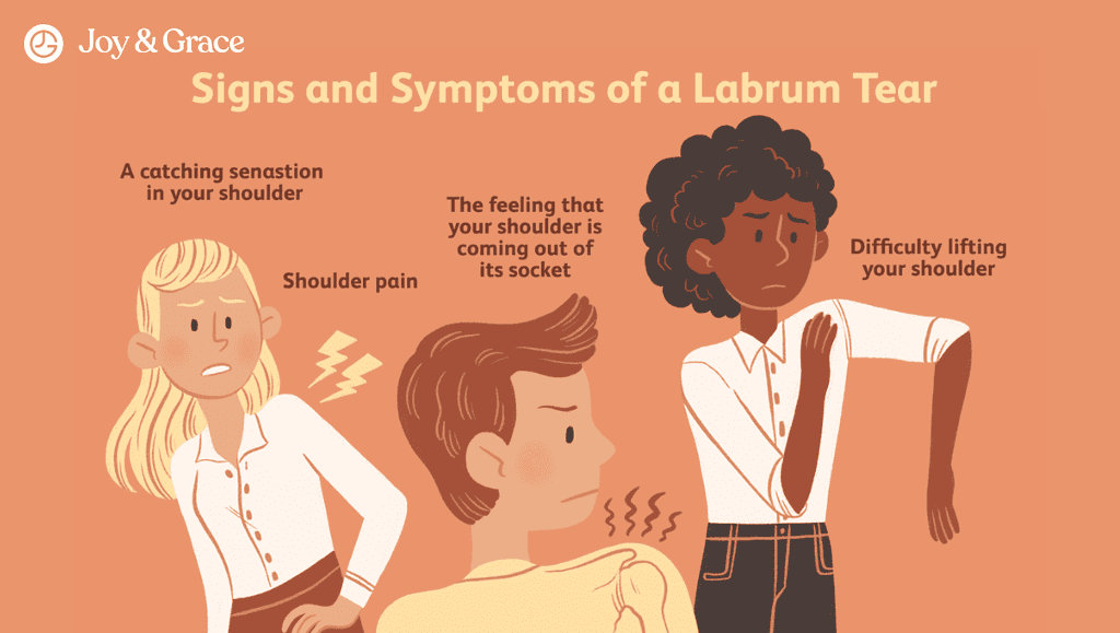 Your Ultimate Guide To Conquering Shoulder Pain From A Torn Labrum